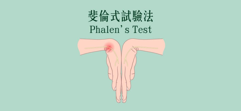 【腕管綜合症】看清滑鼠手原因、症狀、測試、治療及舒緩方法。（2025年專家意見）